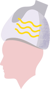 Deep TMS - Prime Psych